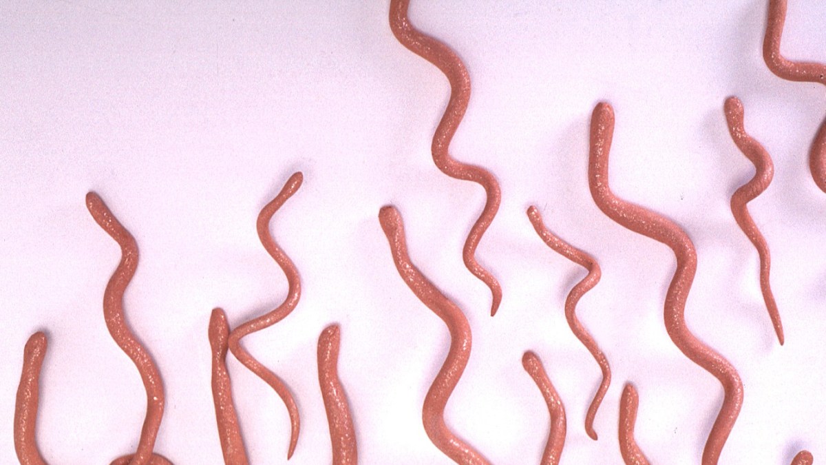 Slithery, Slimy Worms – NBC Chicago