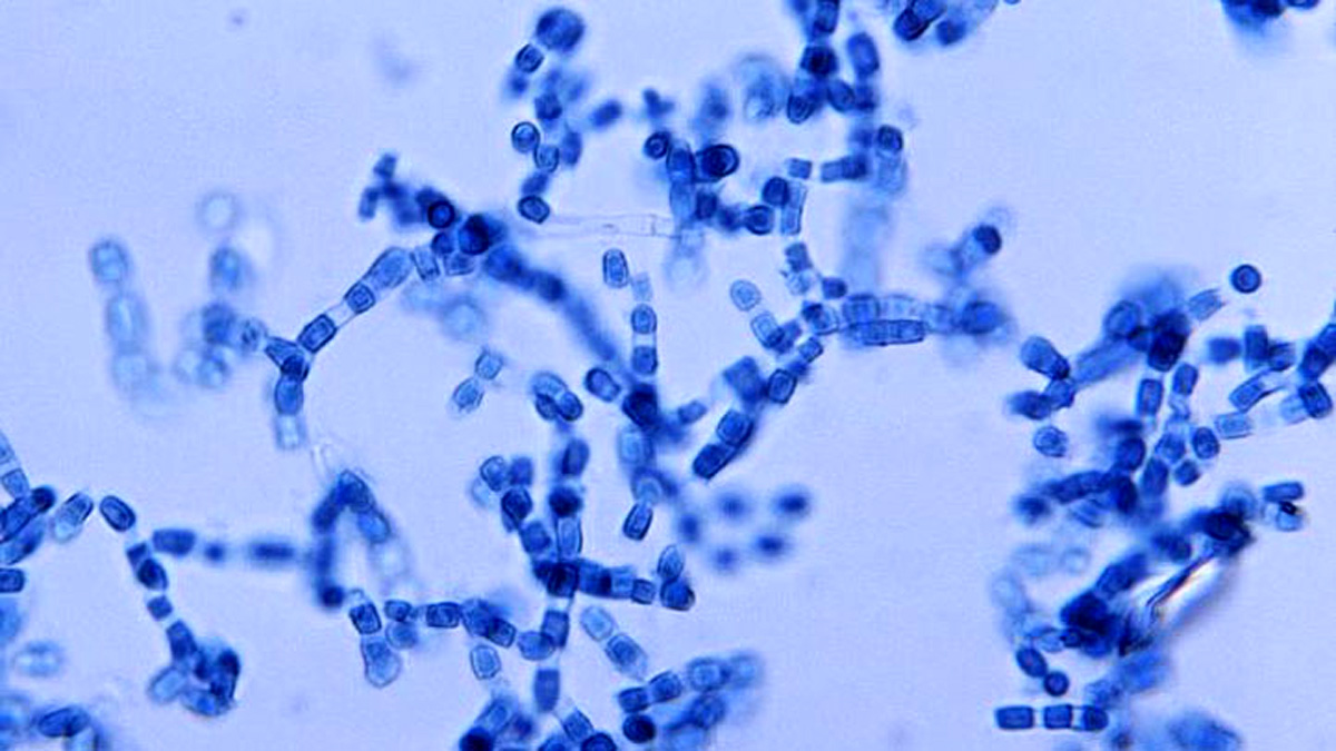 With Flu Making a Comeback After Unusual Year Off, High Activity ...