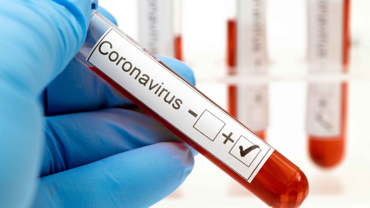 Kane County Confirms First Coronavirus Case – NBC Chicago