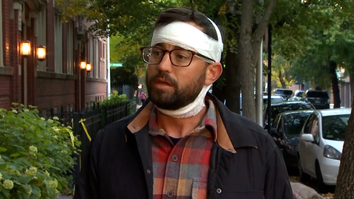 Man Recounts Fighting Off Attempted Armed Carjacking in North Side ...