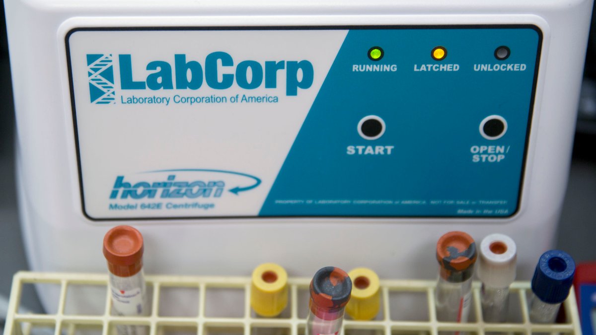 LabCorp to Pay $2.1 Million to Settle DOJ Lawsuit for Allegedly ...