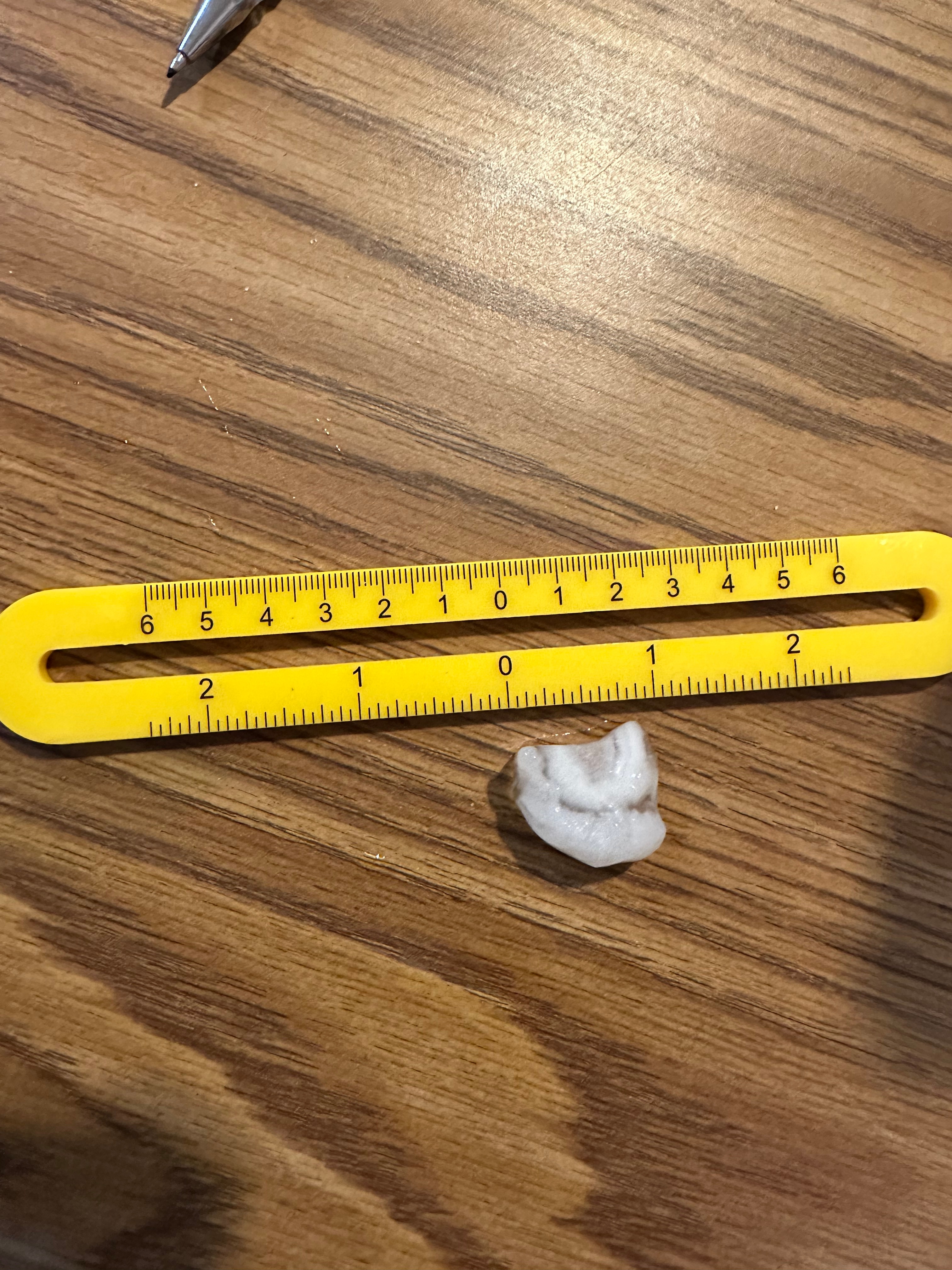 Images Show Massive Hail Spotted Across Chicago Area as Storms Erupt ...