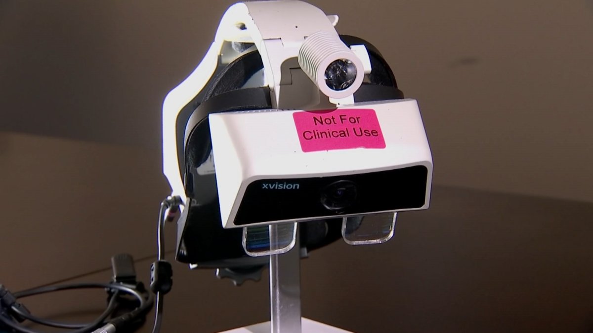 Augmented reality headset changes how spine surgeons ‘see’ – NBC Chicago