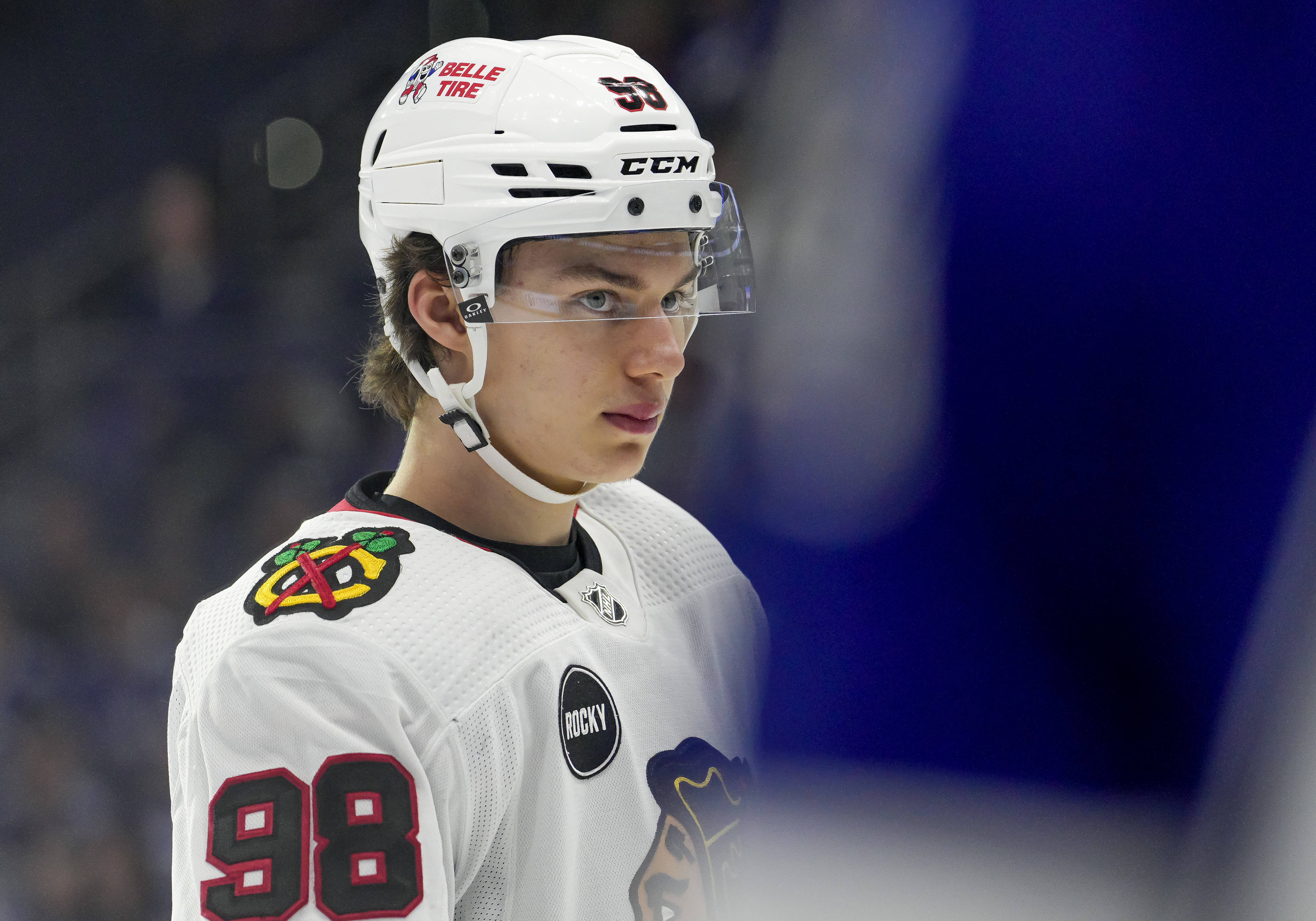 Connor Bedard Injury Update: Hawks star undergoes jaw surgery – NBC Chicago