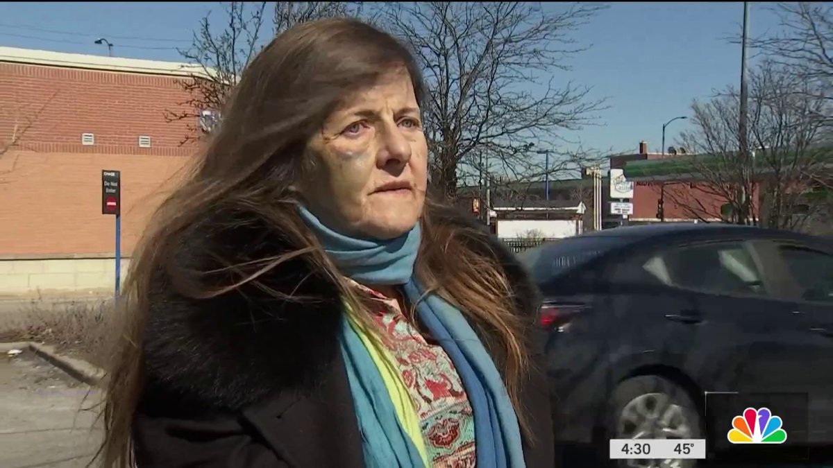 Chicago woman speaks out after attack at drive-through ATM – NBC Chicago