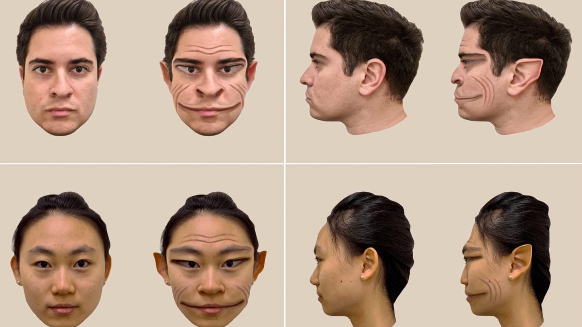 Rare disorder causes man to see ‘demonic’ faces – NBC Chicago