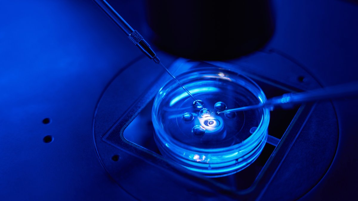 Meet the women who pioneered the development of IVF – NBC Chicago