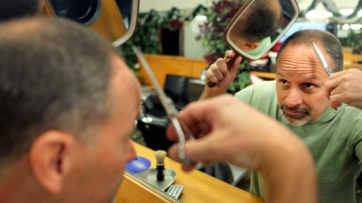 Cutting edge hair loss treatment is repurposed drug from 1990s – NBC ...