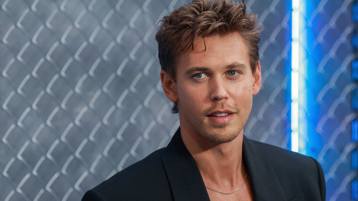 Austin Butler reveals he went temporarily blind – NBC Chicago