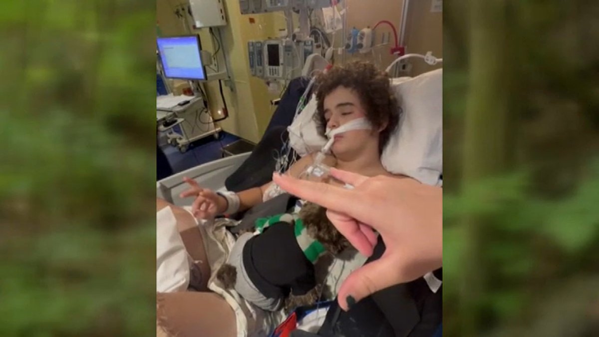 Missouri teen who survived fall wakes up from coma – NBC Chicago
