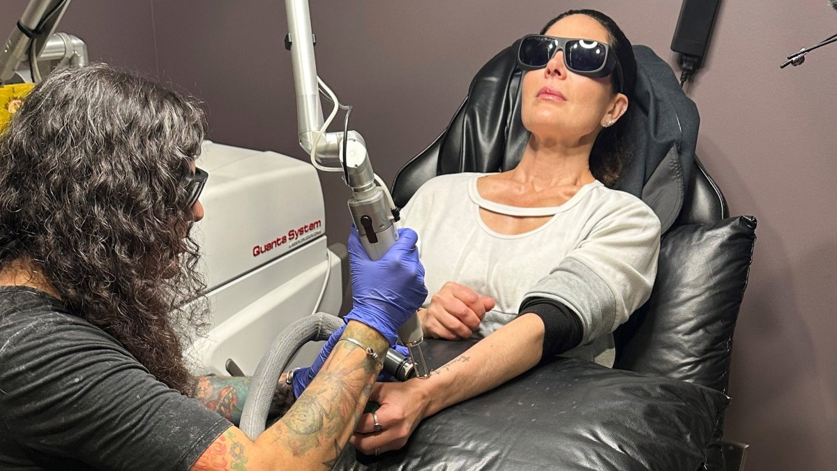 If you want tattoo erased it’s going to be painful and expensive – NBC ...