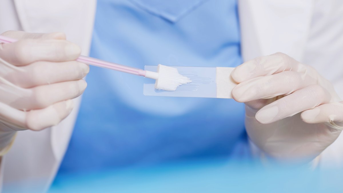 Dread Pap smears? Federal guidelines now allow self-swab HPV test – NBC ...