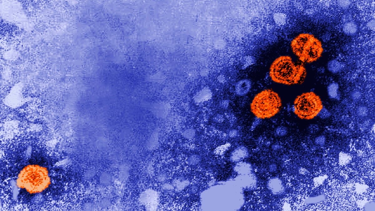 Experimental hepatitis B drug might offer ‘functional cure’ – NBC Chicago