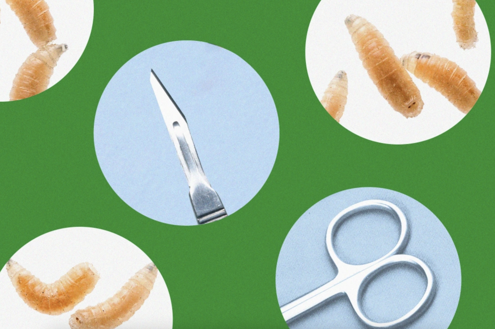 Doctors are bringing maggots into their practice on purpose – NBC Bay Area